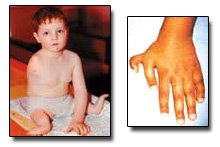 Agentes Mutagénicos